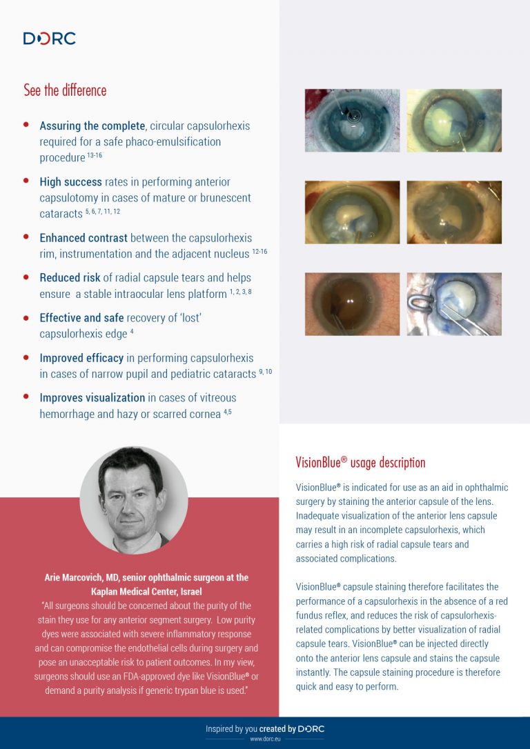 DORC VisionBlue brochure syringe - SURGICAL SERVICE PORTUGAL LDA